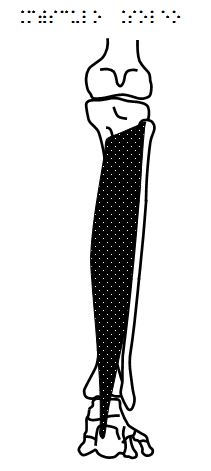 Extremidad inferior. Músculo soleo — weonce